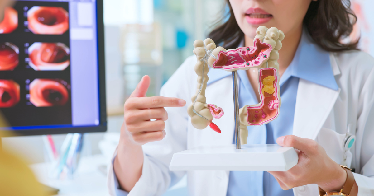 Advanced colon polyp treatment | Nebraska Medicine Omaha, NE