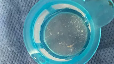 Repair aortic stenosis with TAVR | Nebraska Medicine Omaha, NE